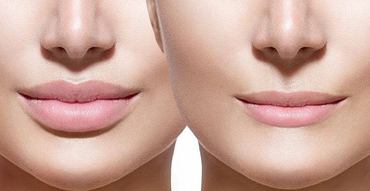 How To Get Smaller Lips Put Kate Council